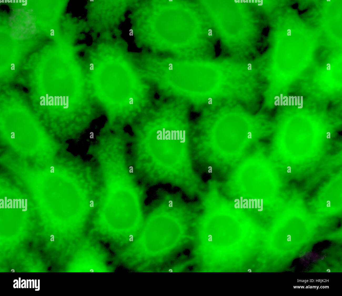 Human glial cell micrograph hi-res stock photography and images - Alamy