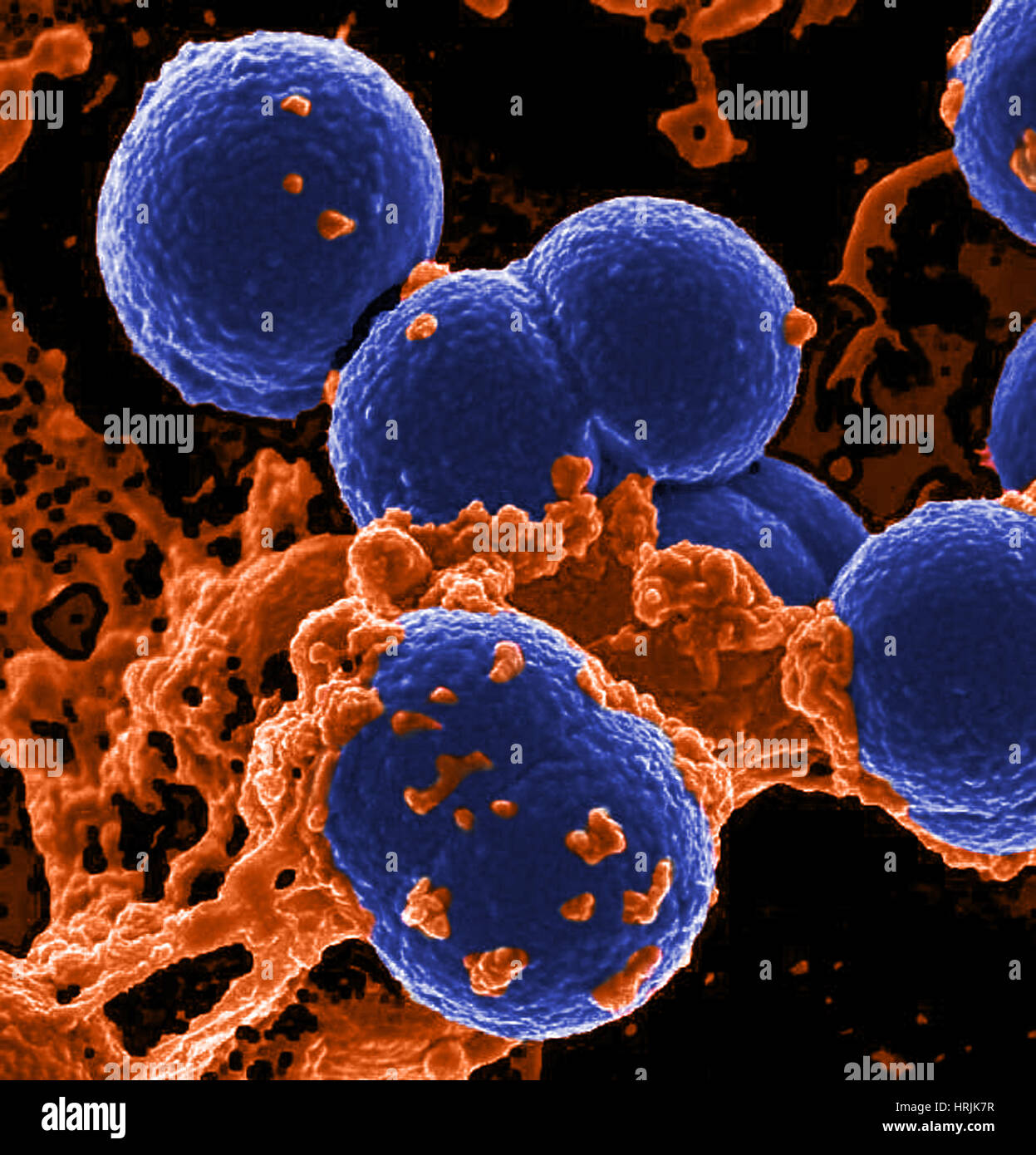 Neutrophil Ingesting MRSA Bacteria, SEM Stock Photo - Alamy