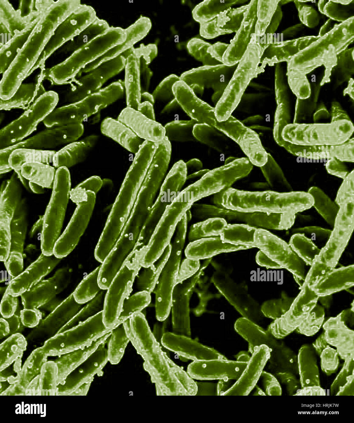 Mycobacterium tuberculosis Bacteria, SEM Stock Photo - Alamy