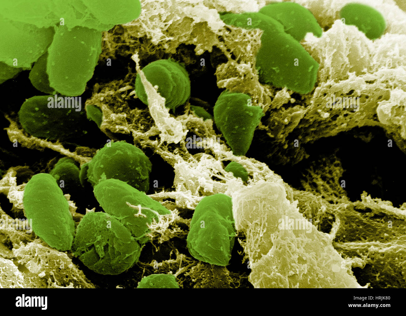 Yersinia pestis gram hi-res stock photography and images - Alamy