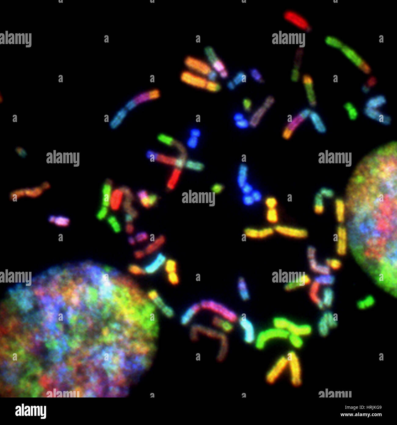 Spectral karyotyping hi-res stock photography and images - Alamy