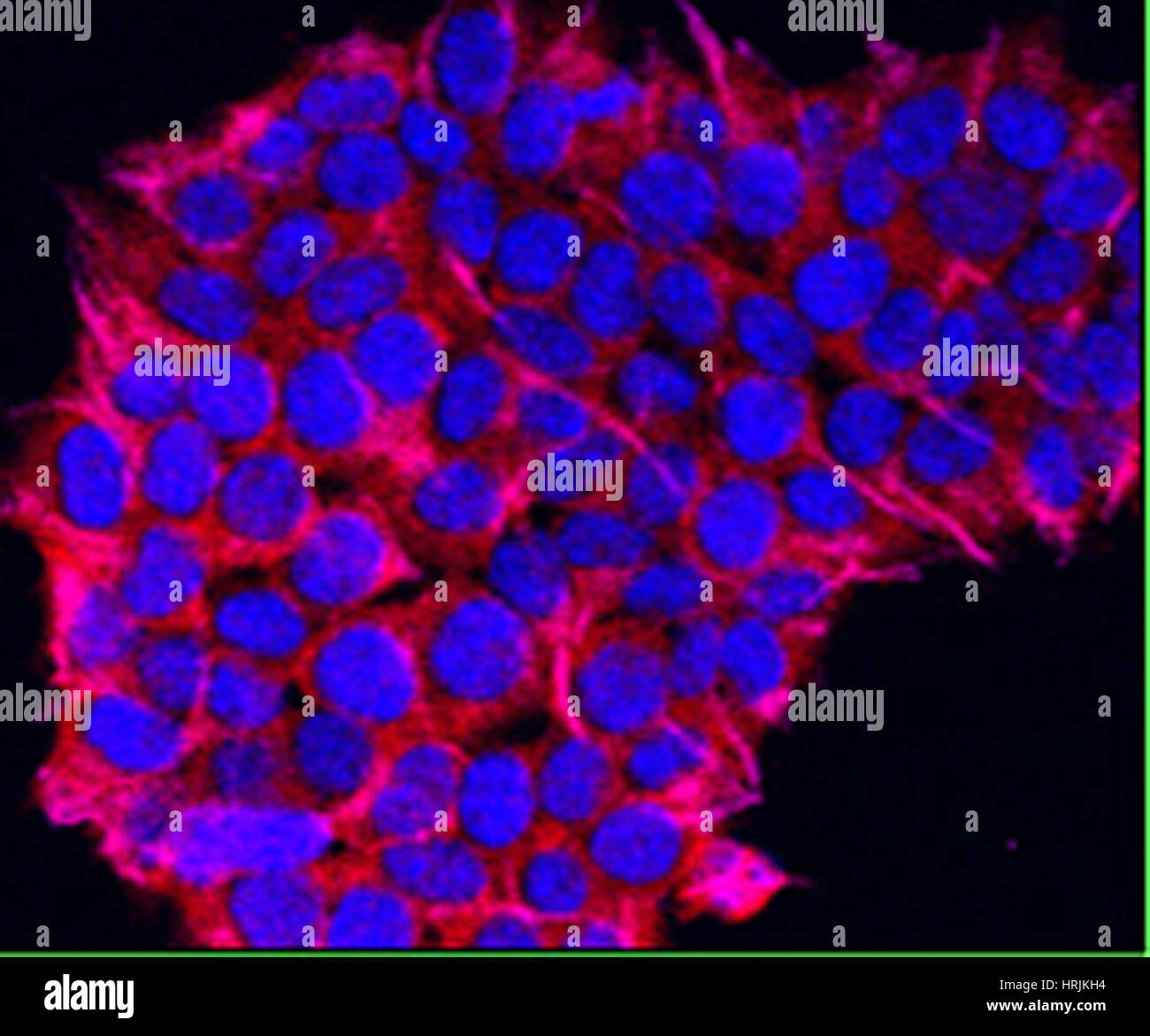 Confocal microscopy hi-res stock photography and images - Alamy