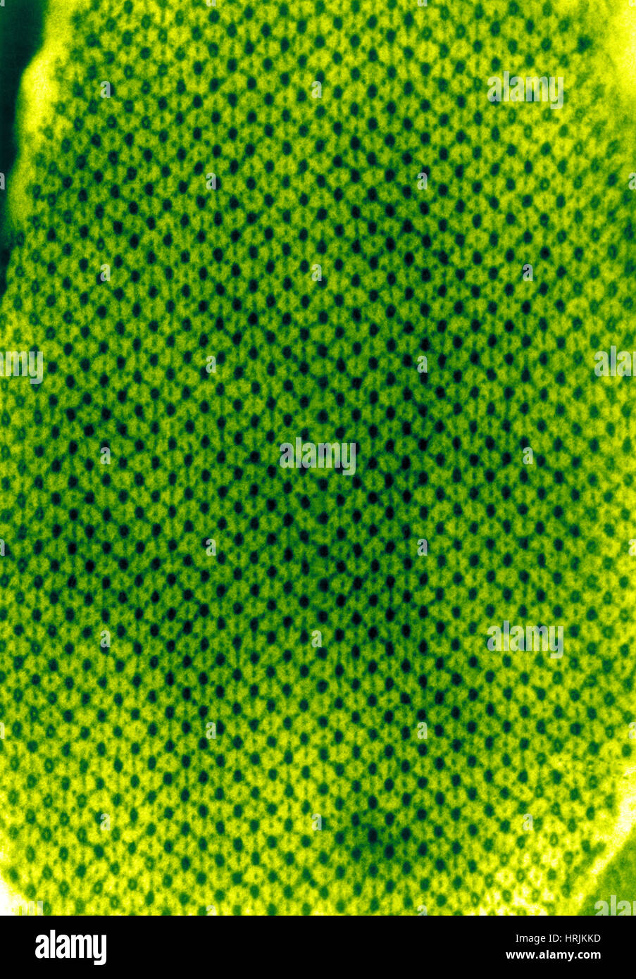 Muscle fibers cross section hi-res stock photography and images - Alamy