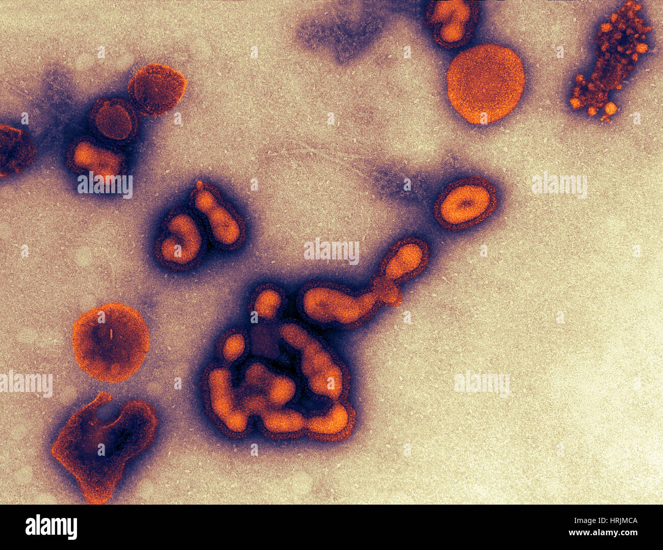H1N1, Influenza A, Russian Flu, TEM Stock Photo - Alamy