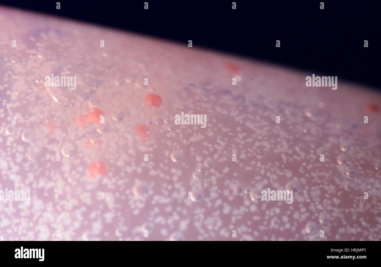 Microbeads, Macro Image Stock Photo - Alamy