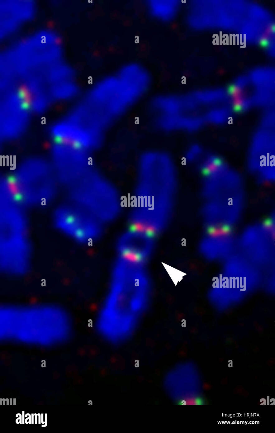 Dicentric Chromosomes, LM Stock Photo - Alamy