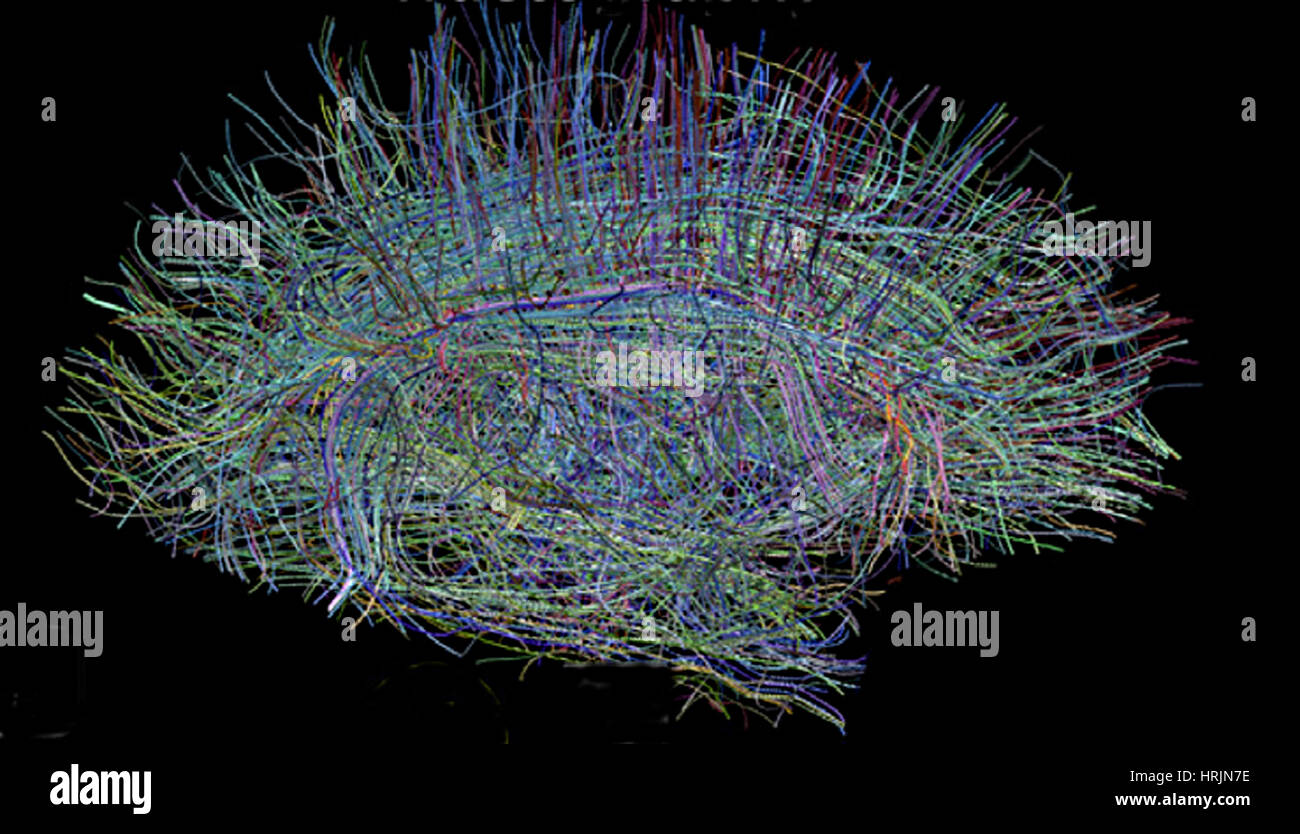 Connectome human brain hi-res stock photography and images - Alamy