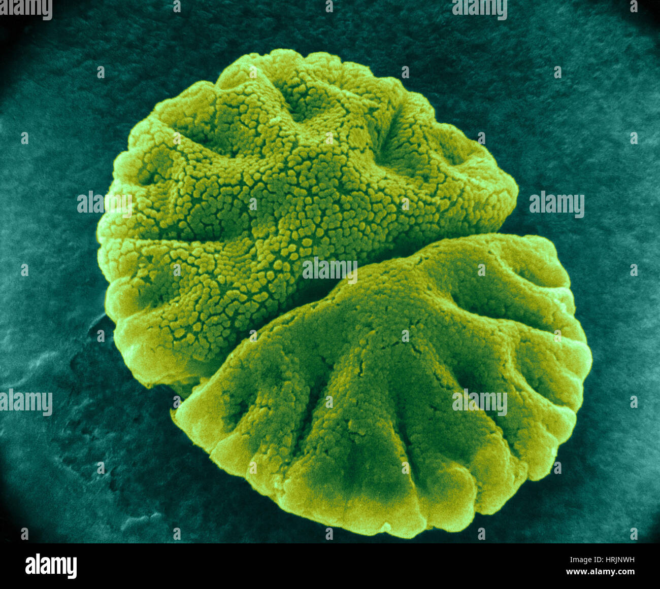 Micrasterias angulosa, Algae, SEM Stock Photo - Alamy
