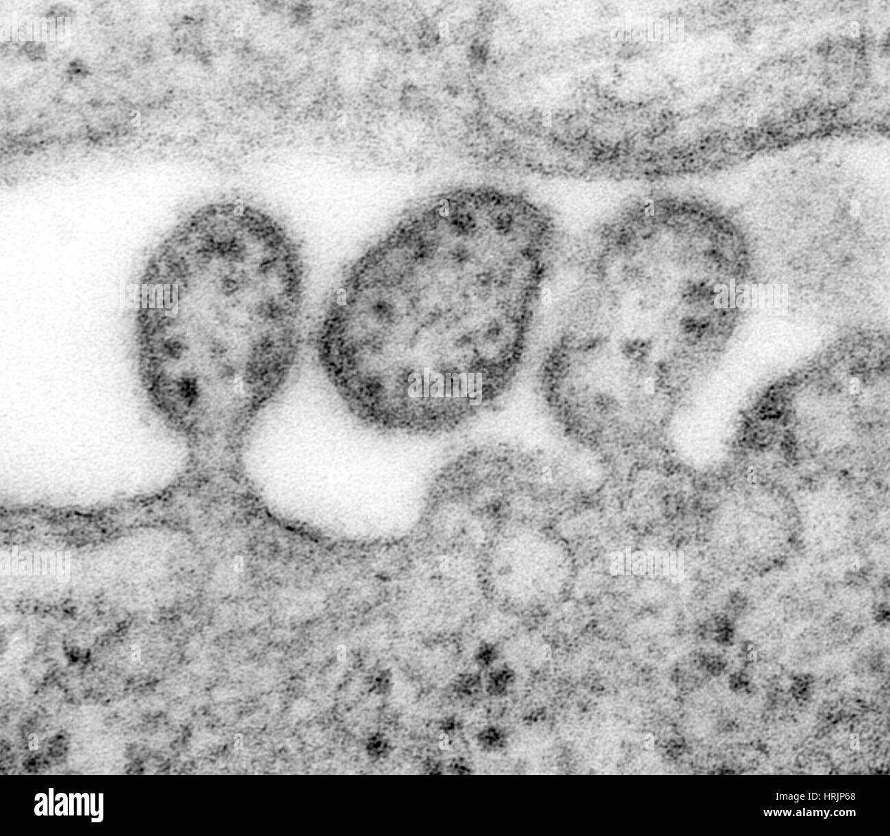 Lassa fever Black and White Stock Photos & Images - Alamy