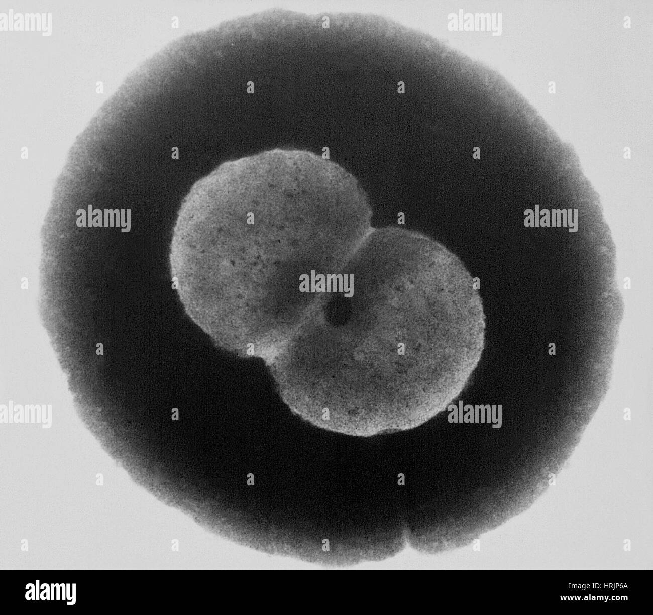 Neisseria gonorrhoeae Bacteria, TEM Stock Photo - Alamy