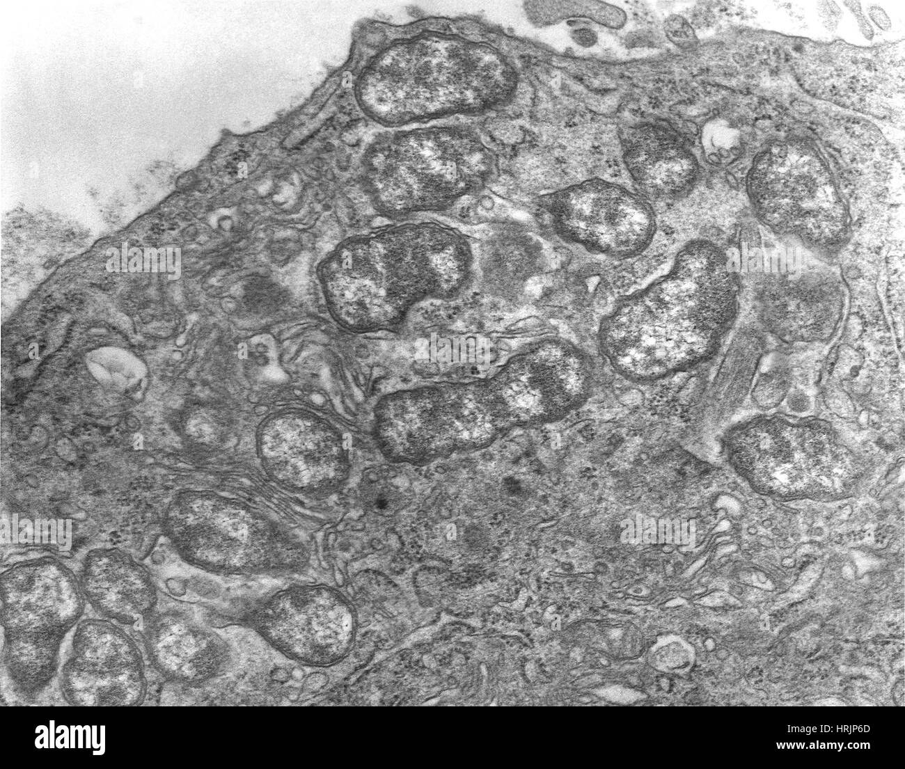 Rickettsia bacteria hi-res stock photography and images - Alamy
