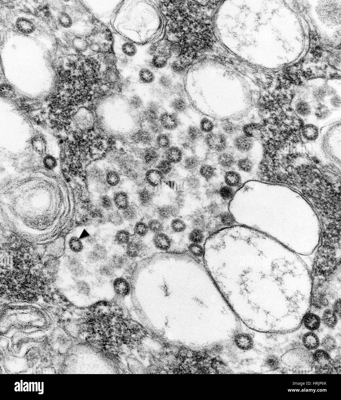 SARS Virus, TEM Stock Photo - Alamy