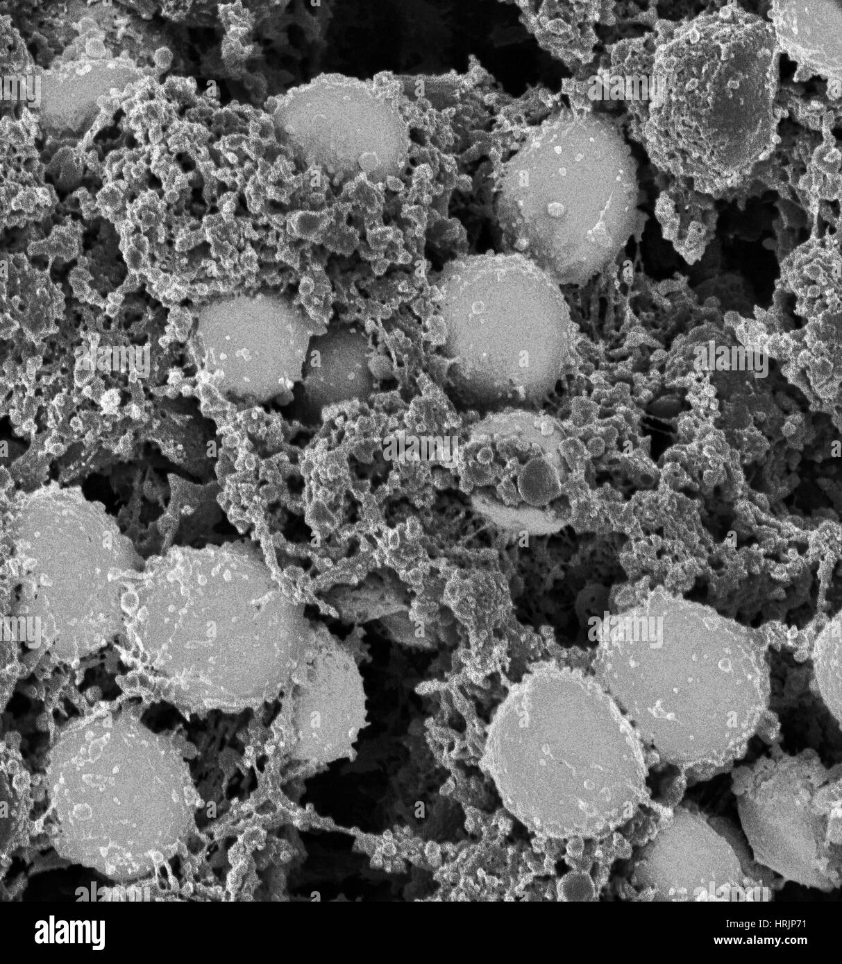 Staphylococcus aureus Bacteria, SEM Stock Photo - Alamy Staphylococcus aureus Bacteria, SEM Stock Photo - Alamy