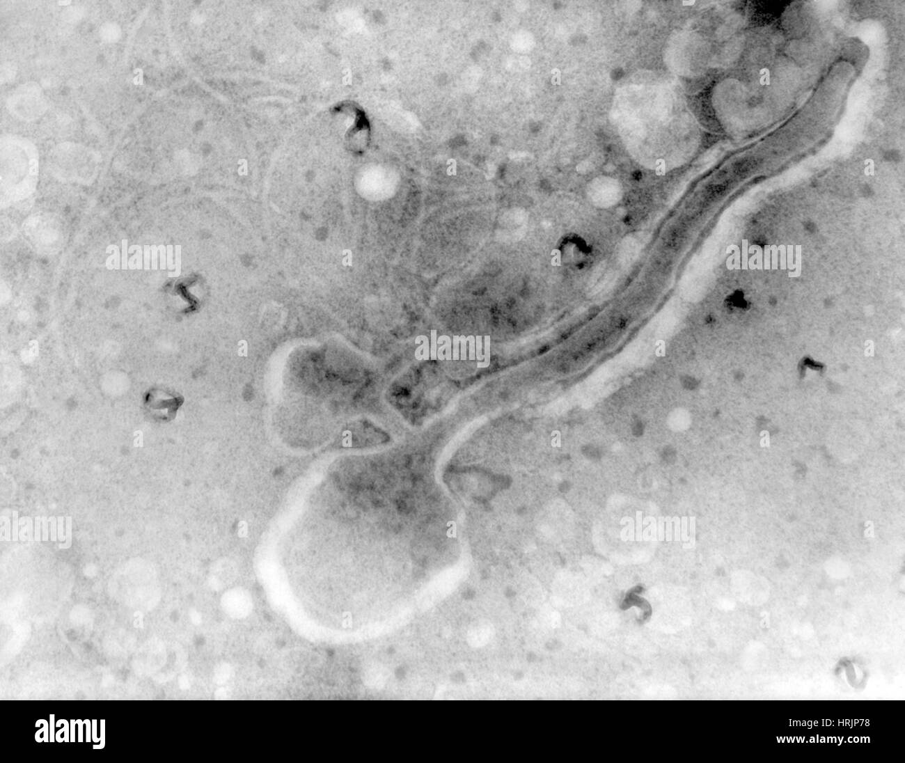 Treponema pallidum micrograph hi-res stock photography and images - Alamy