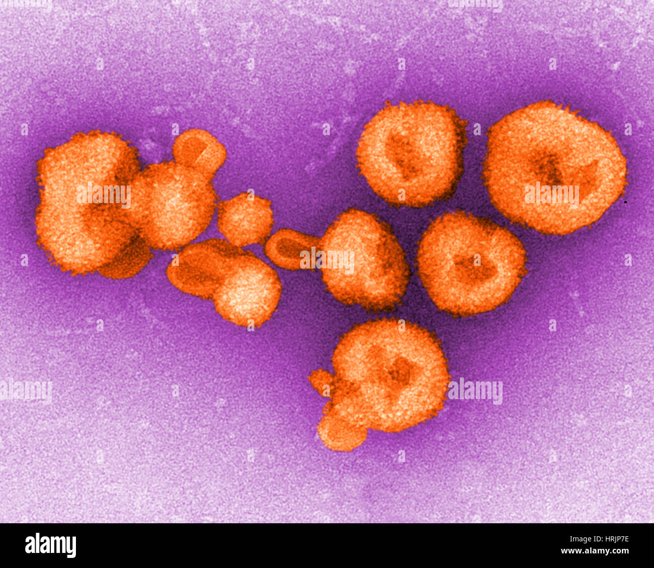 Lassa Virus, TEM Stock Photo - Alamy