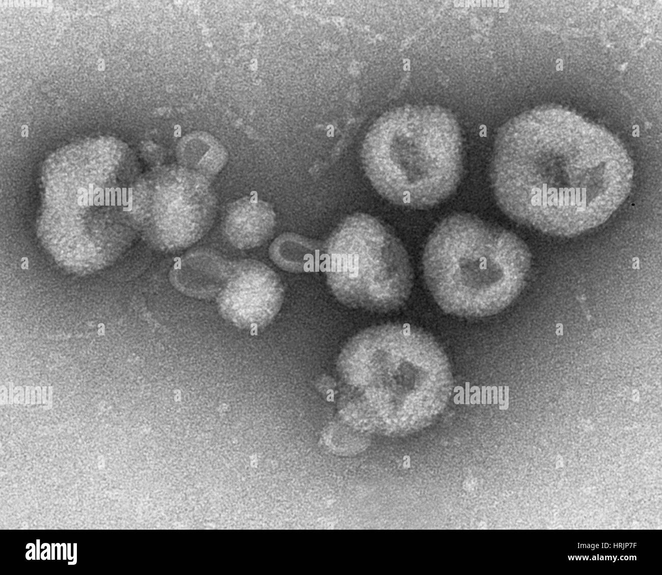 Lassa fever Black and White Stock Photos & Images - Alamy