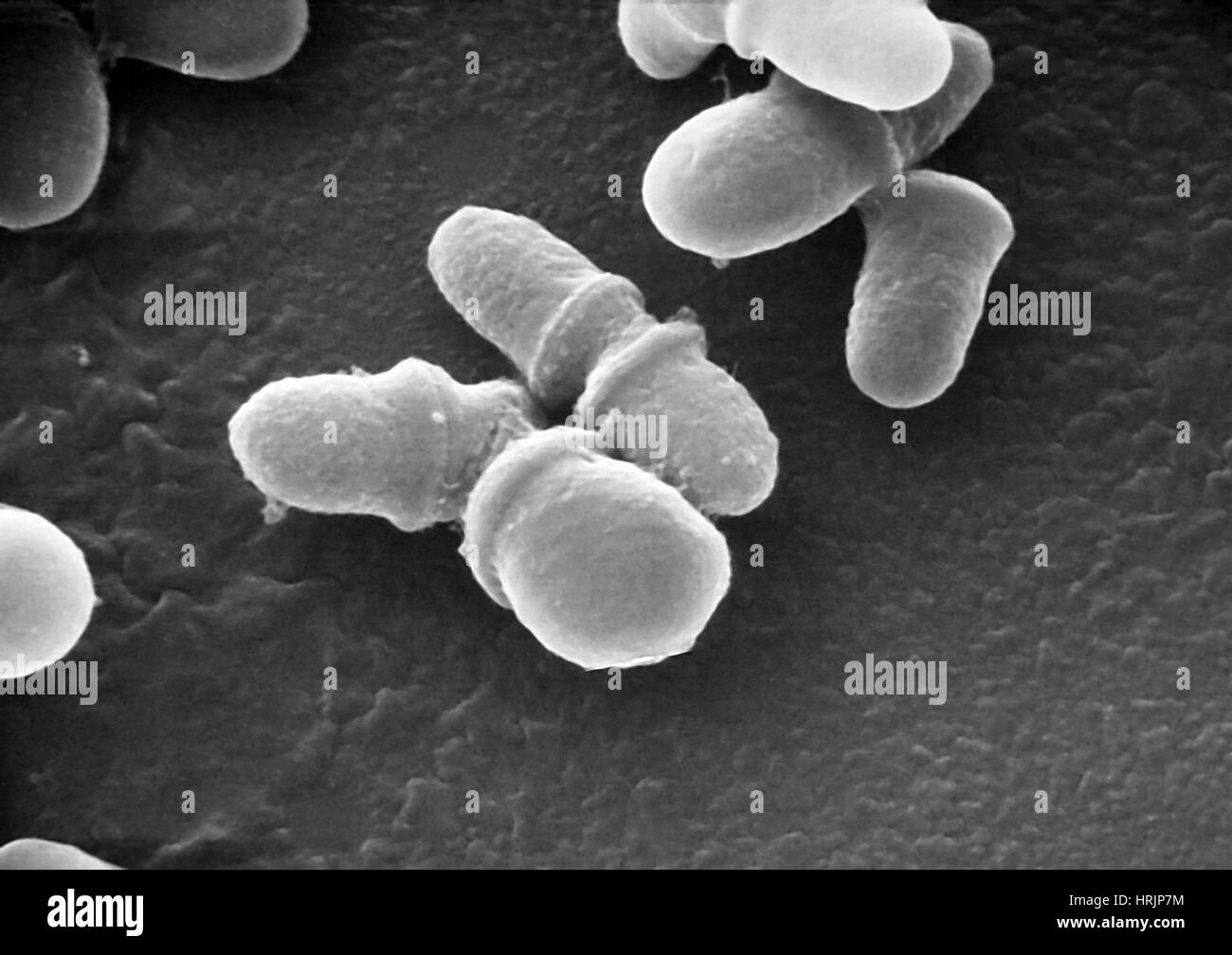 Malassezia Fungus, SEM Stock Photo - Alamy