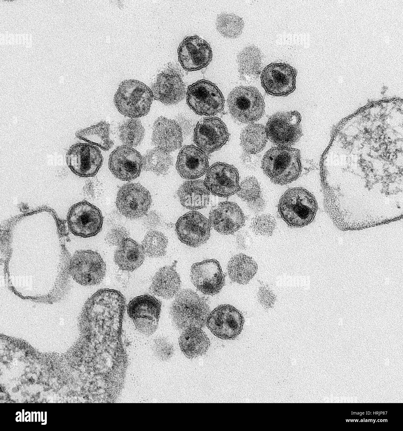 Electron Microscope Hiv