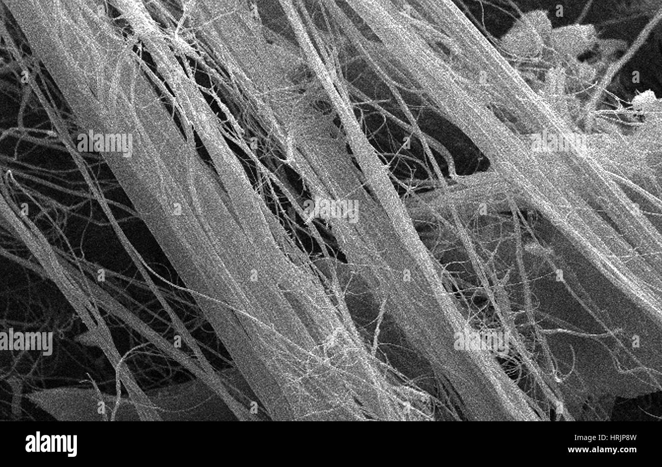 Scanning electron micrograph asbestos hi-res stock photography and ...