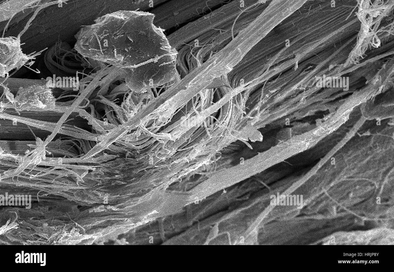 Asbestos, SEM Stock Photo - Alamy