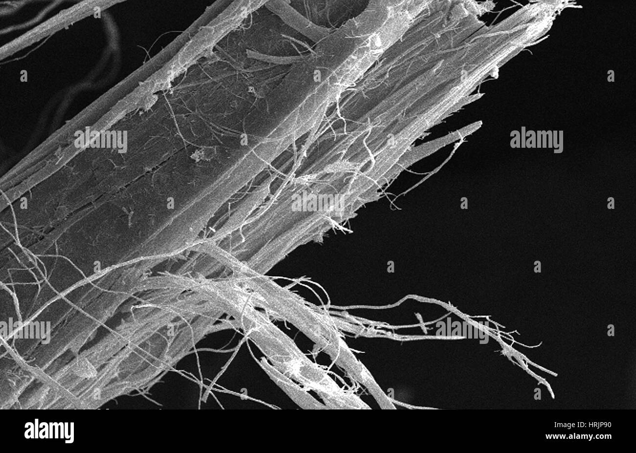 Scanning electron micrograph asbestos hi-res stock photography and ...