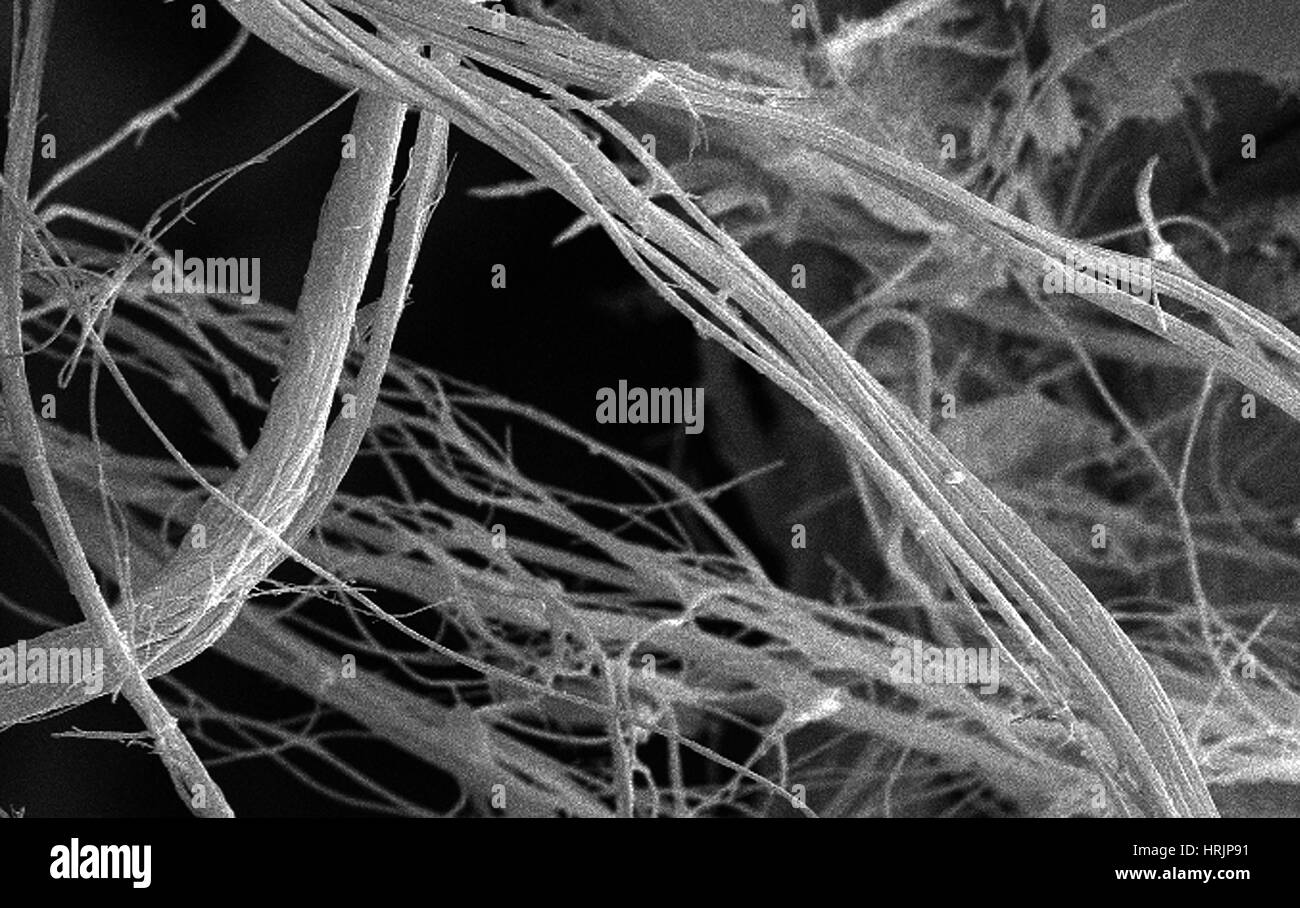 Scanning electron micrograph asbestos hi-res stock photography and ...