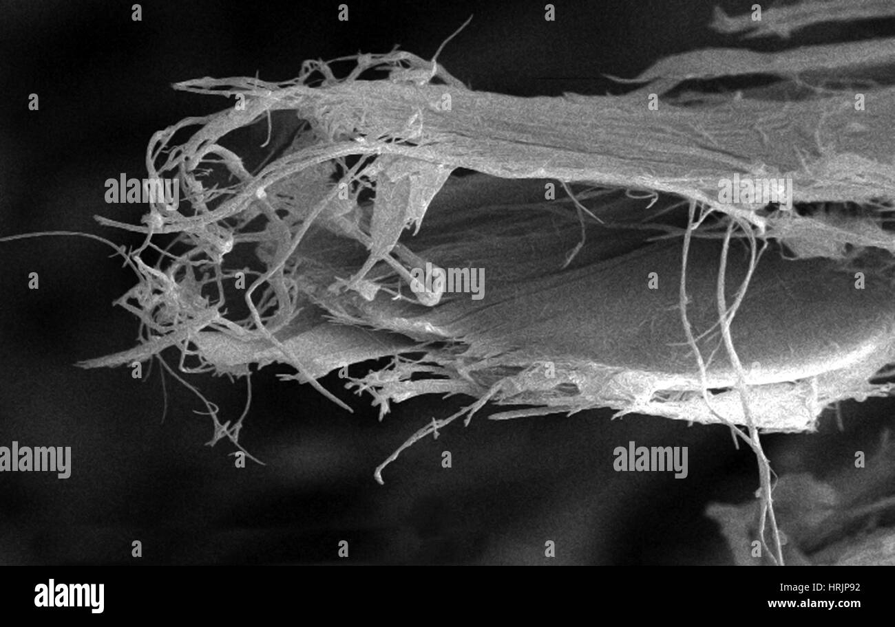 Scanning electron micrograph asbestos hi-res stock photography and ...