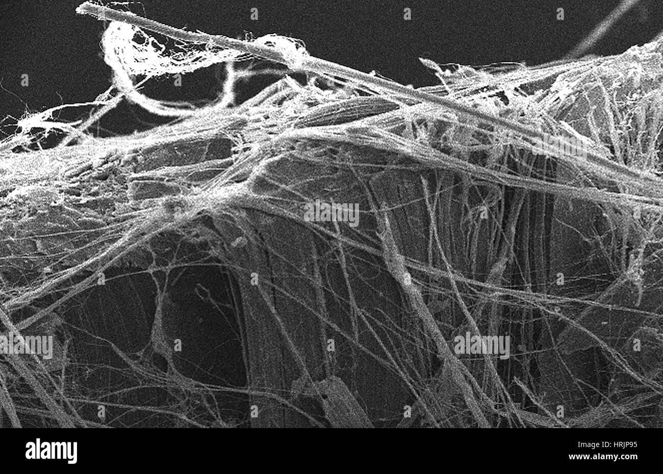 Scanning electron micrograph asbestos hi-res stock photography and ...