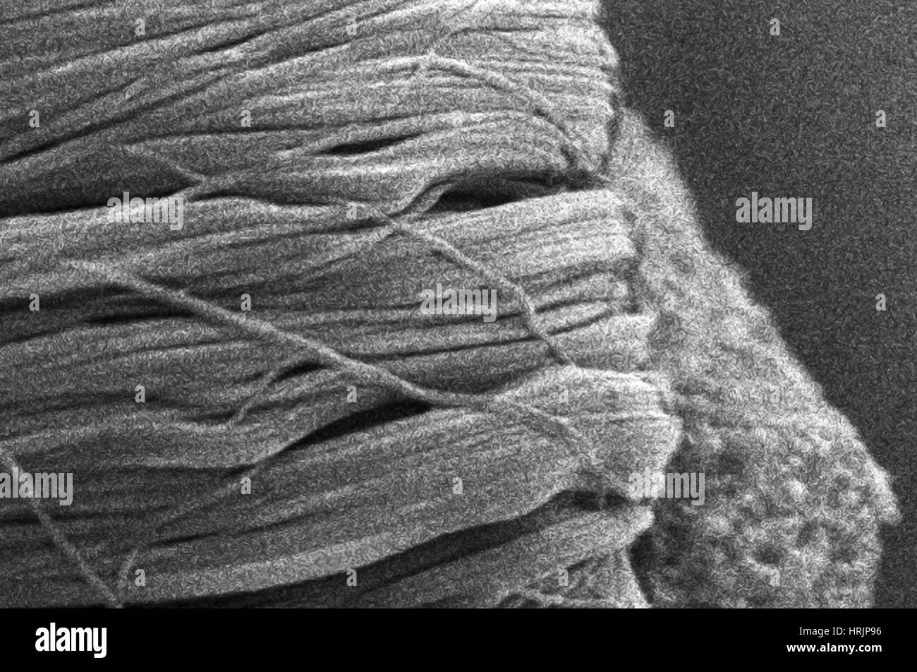 Scanning electron micrograph asbestos hi-res stock photography and ...