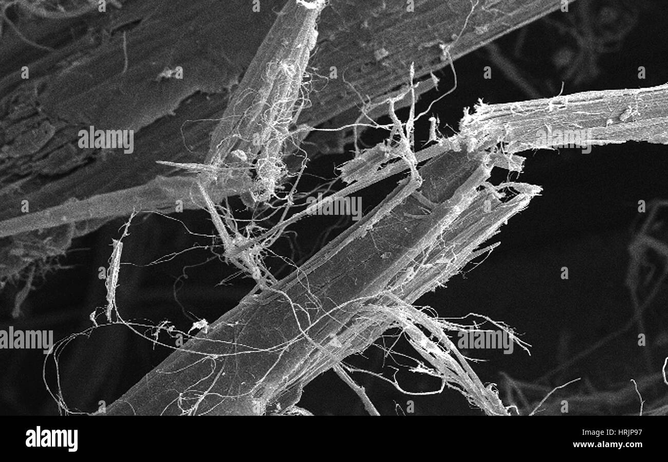 Scanning Electron Micrograph Asbestos High Resolution Stock Photography ...