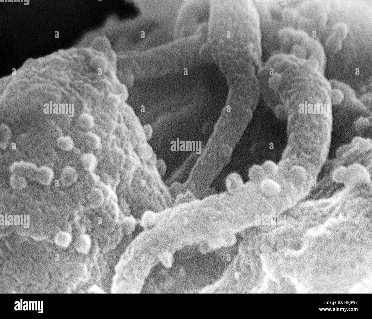 HIV-1, Human Immunodeficiency Virus, SEM Stock Photo - Alamy