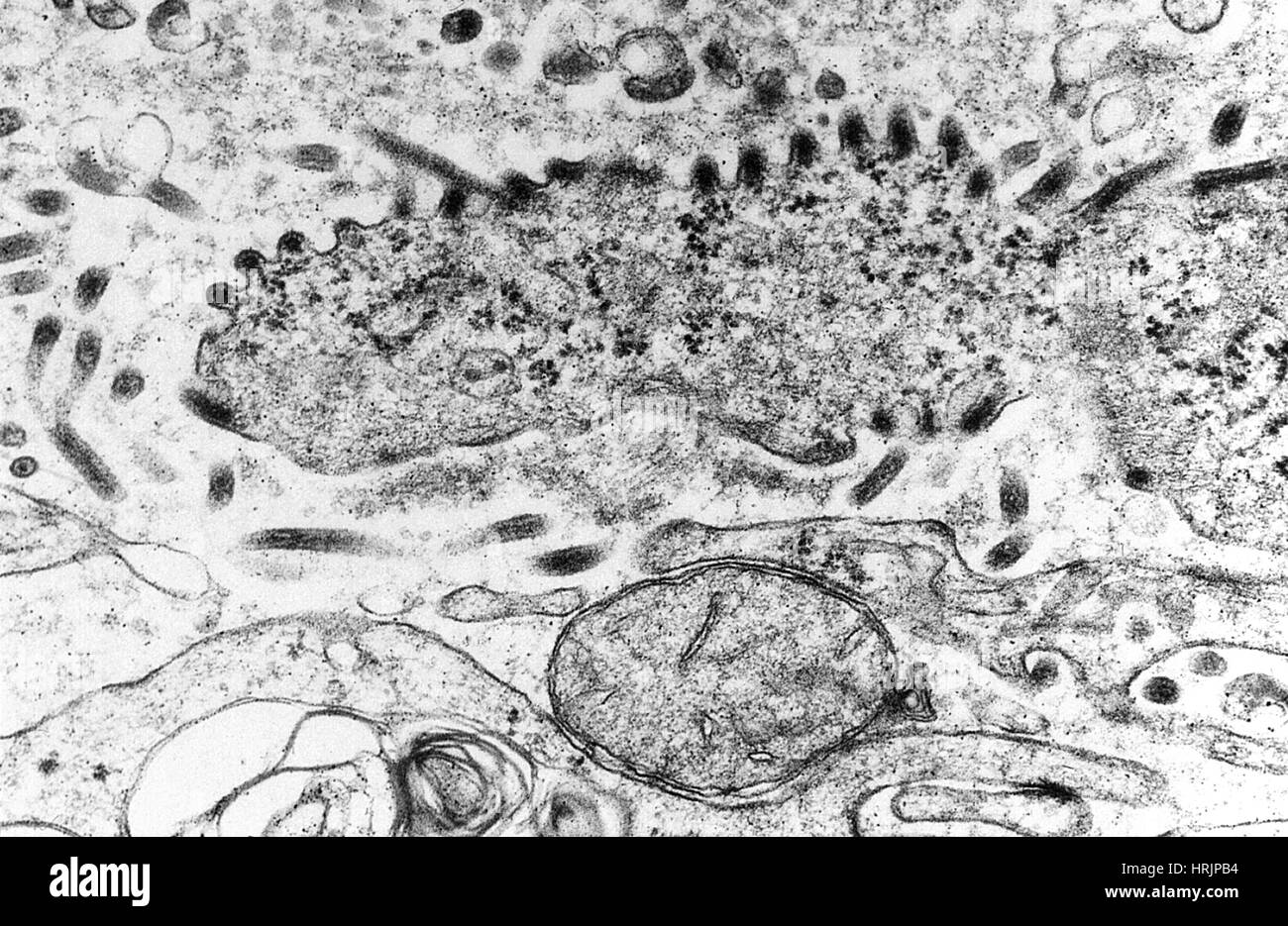 Viral haemorrhagic fever virus hi-res stock photography and images - Alamy