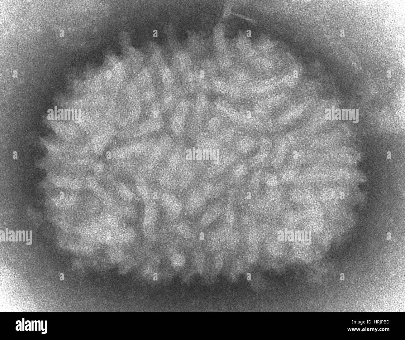 Vaccinia Virus, Eradicated Smallpox, EM Stock Photo - Alamy