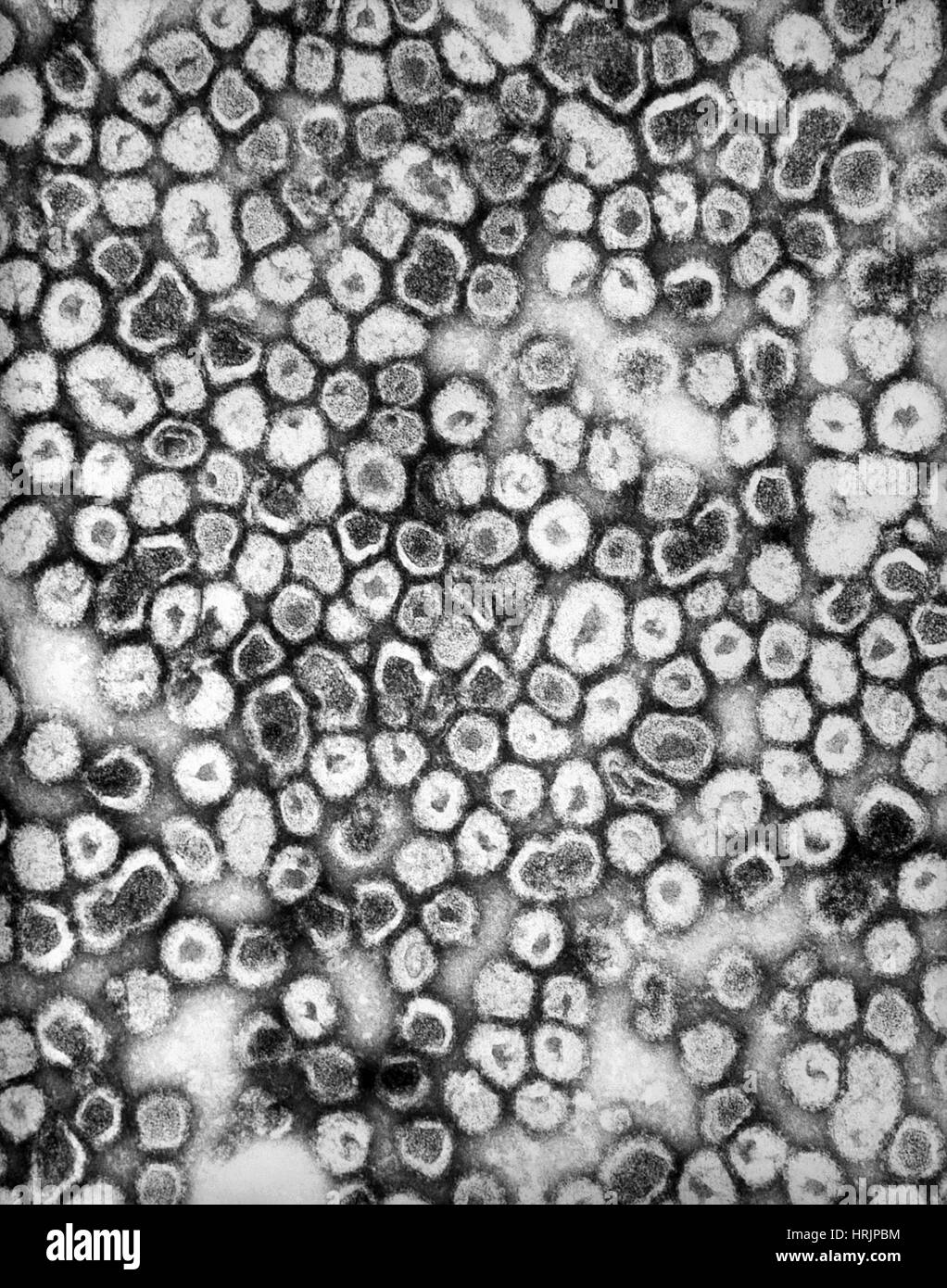 La Crosse Virus, TEM Stock Photo - Alamy