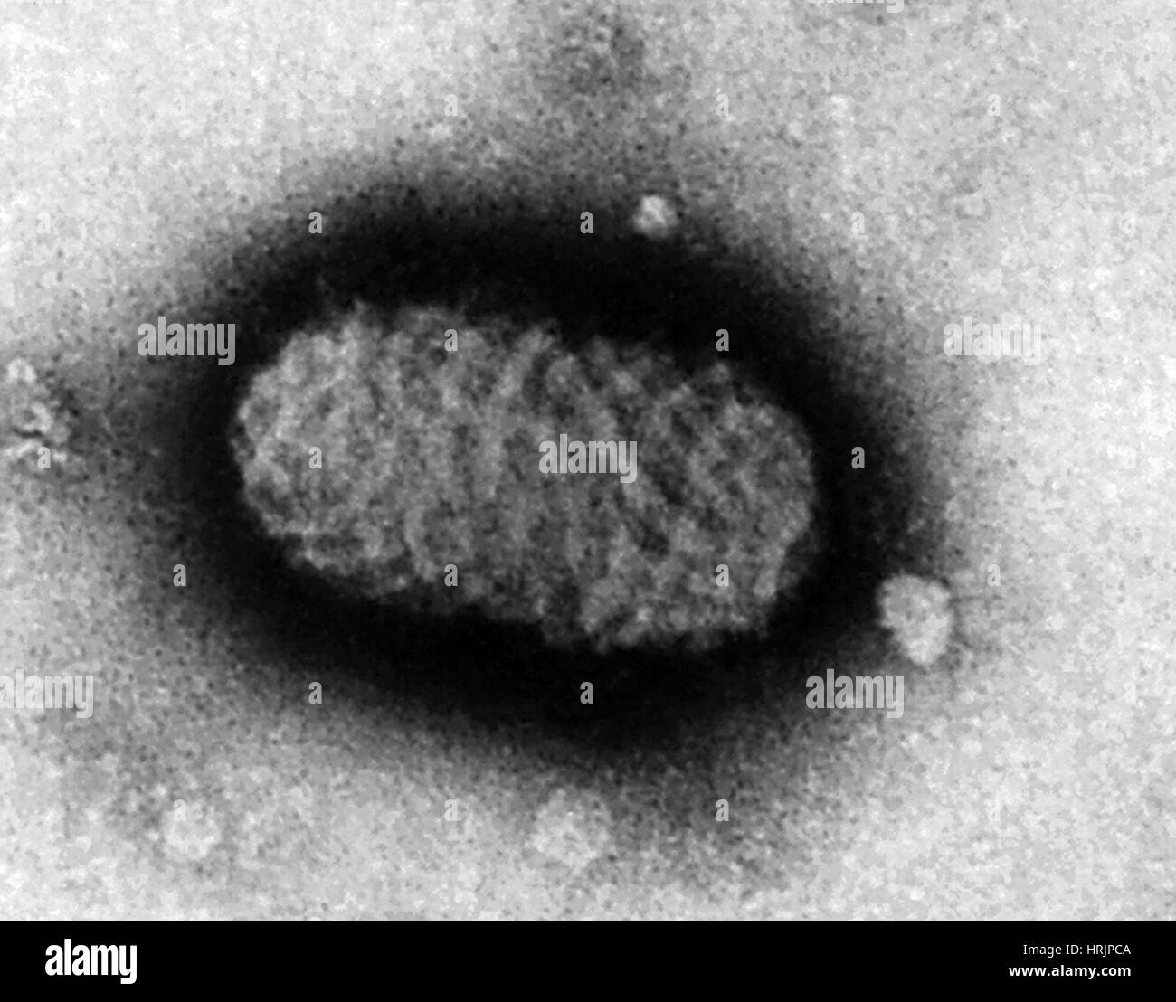 Orf Virus, TEM Stock Photo - Alamy