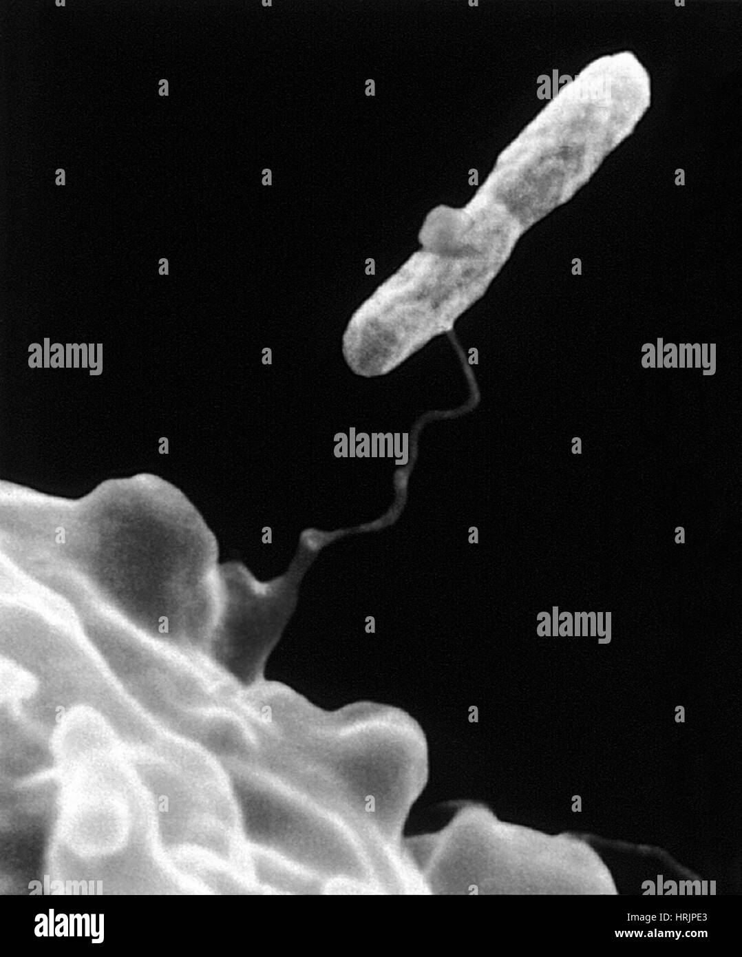 Entrapped Legionella pneumophila Bacterium, SEM Stock Photo - Alamy