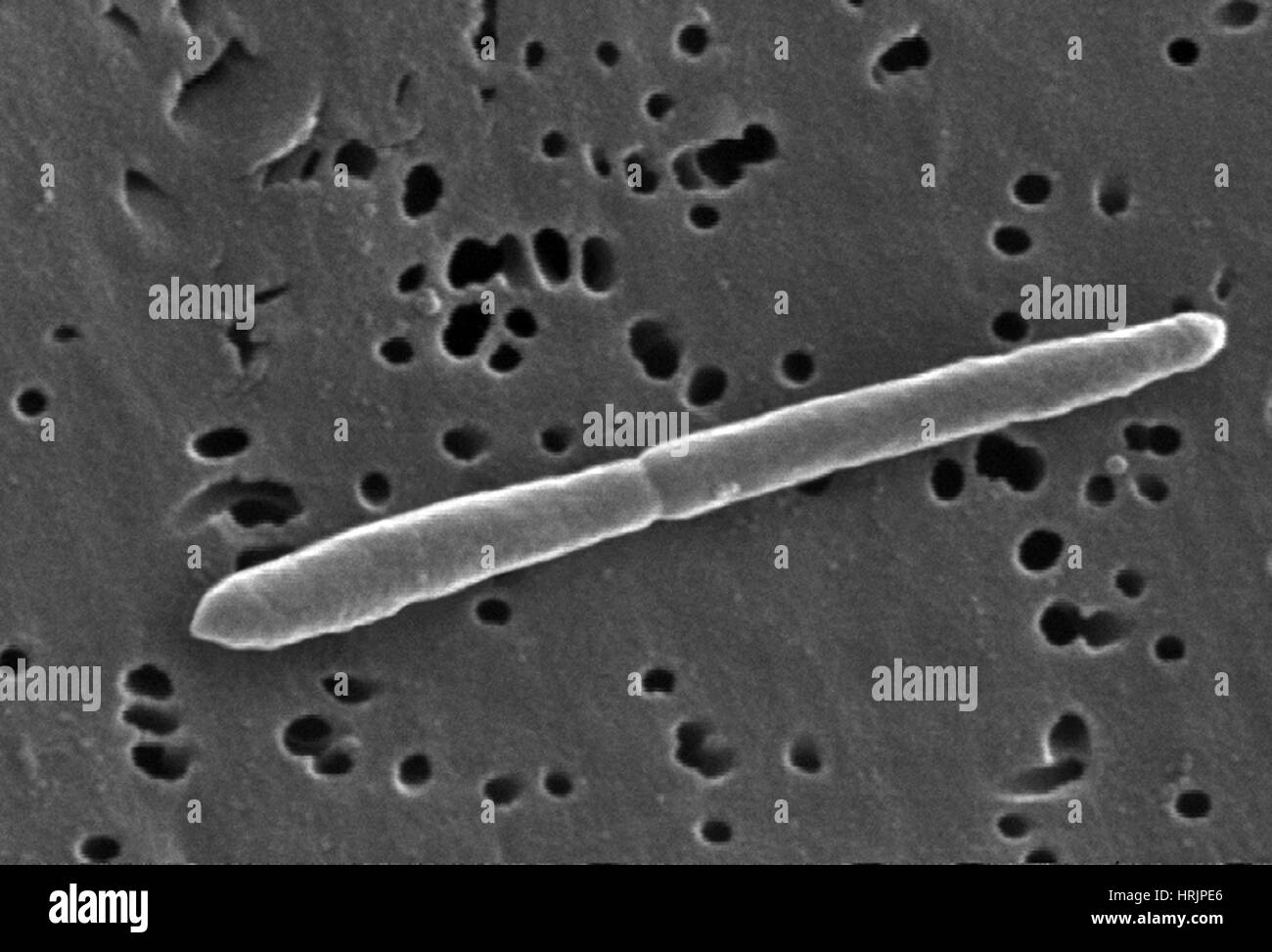 Scanning electron microscopy archaea hi-res stock photography and ...