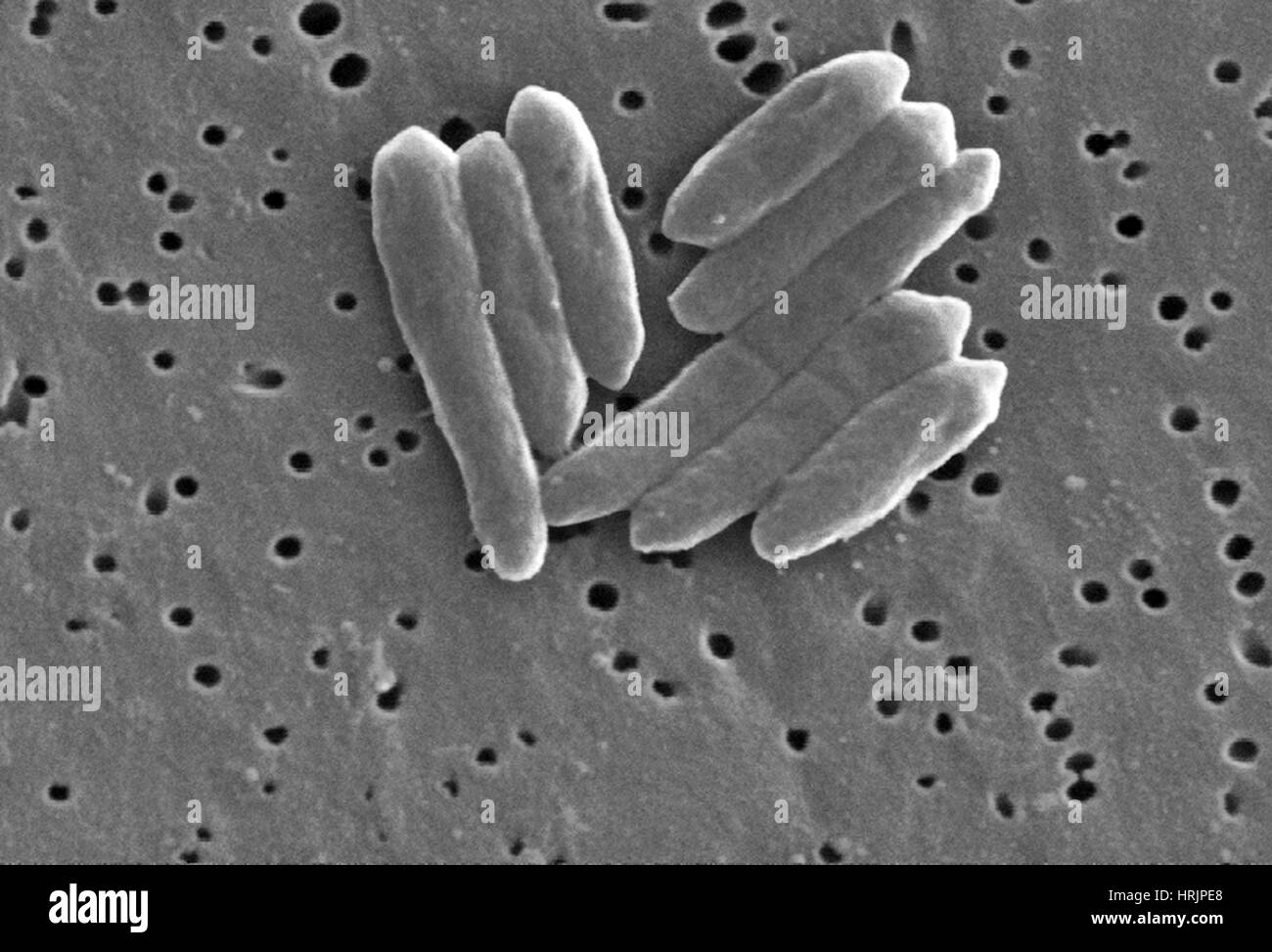 Scanning electron microscopy archaea hi-res stock photography and images - Alamy