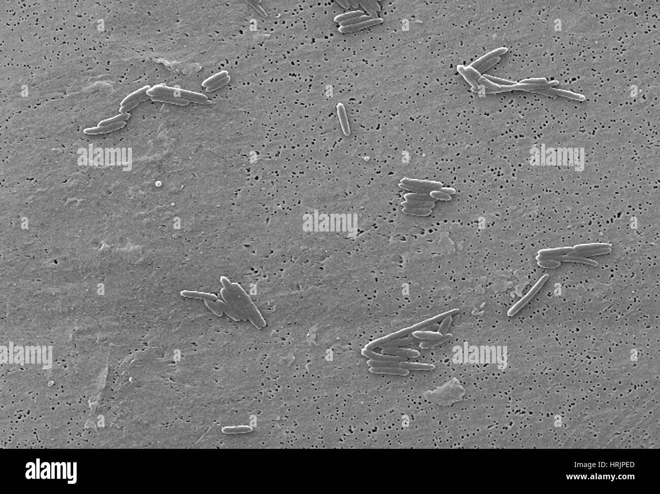 Scanning electron microscopy archaea hi-res stock photography and ...