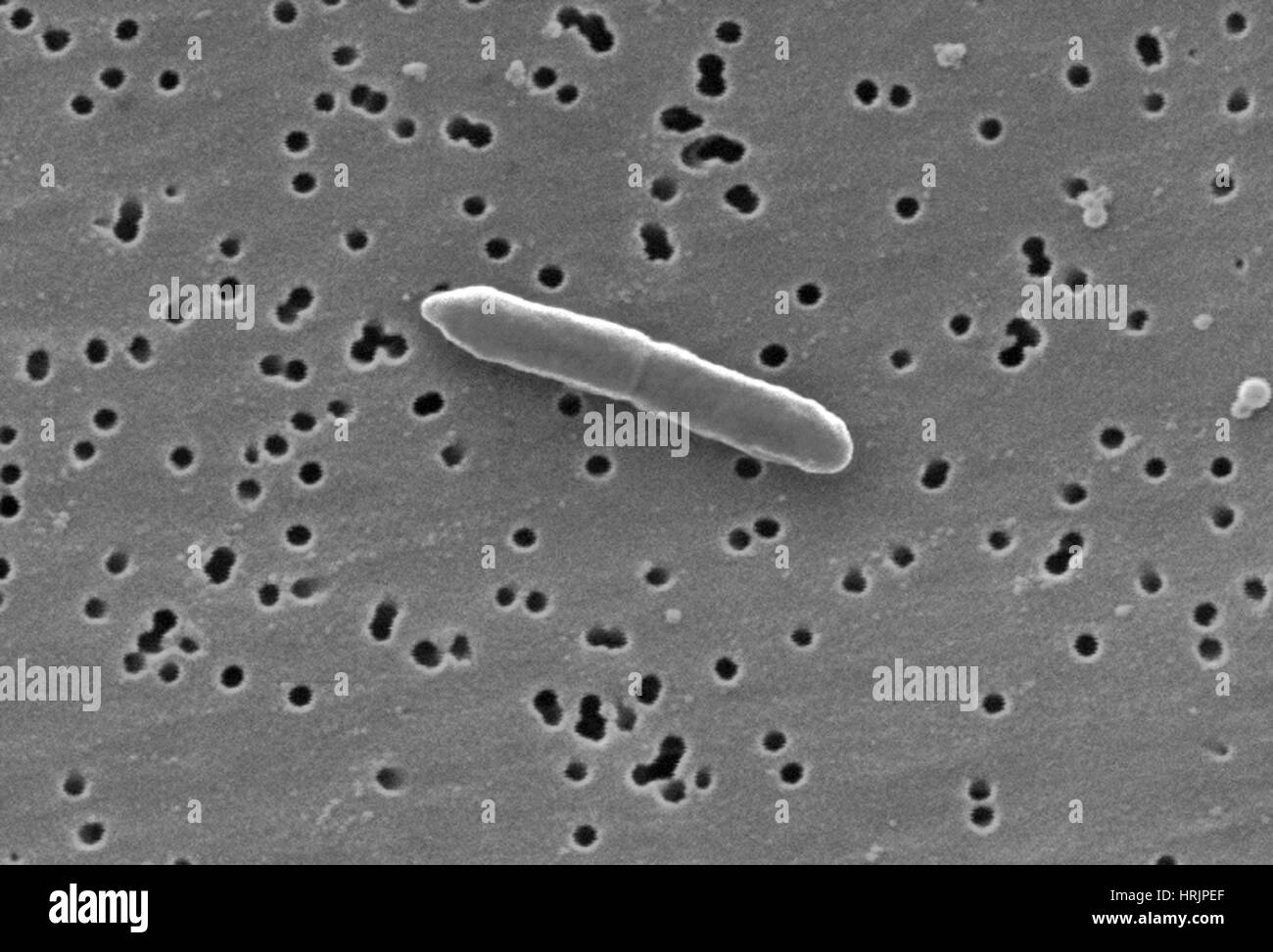 Scanning electron microscopy archaea hi-res stock photography and ...