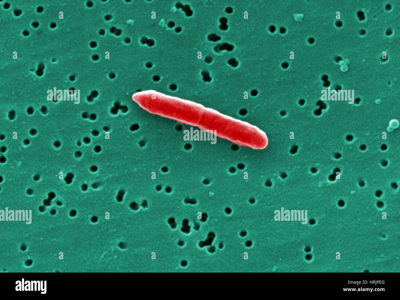 Scanning electron micrograph archaea hi-res stock photography and ...