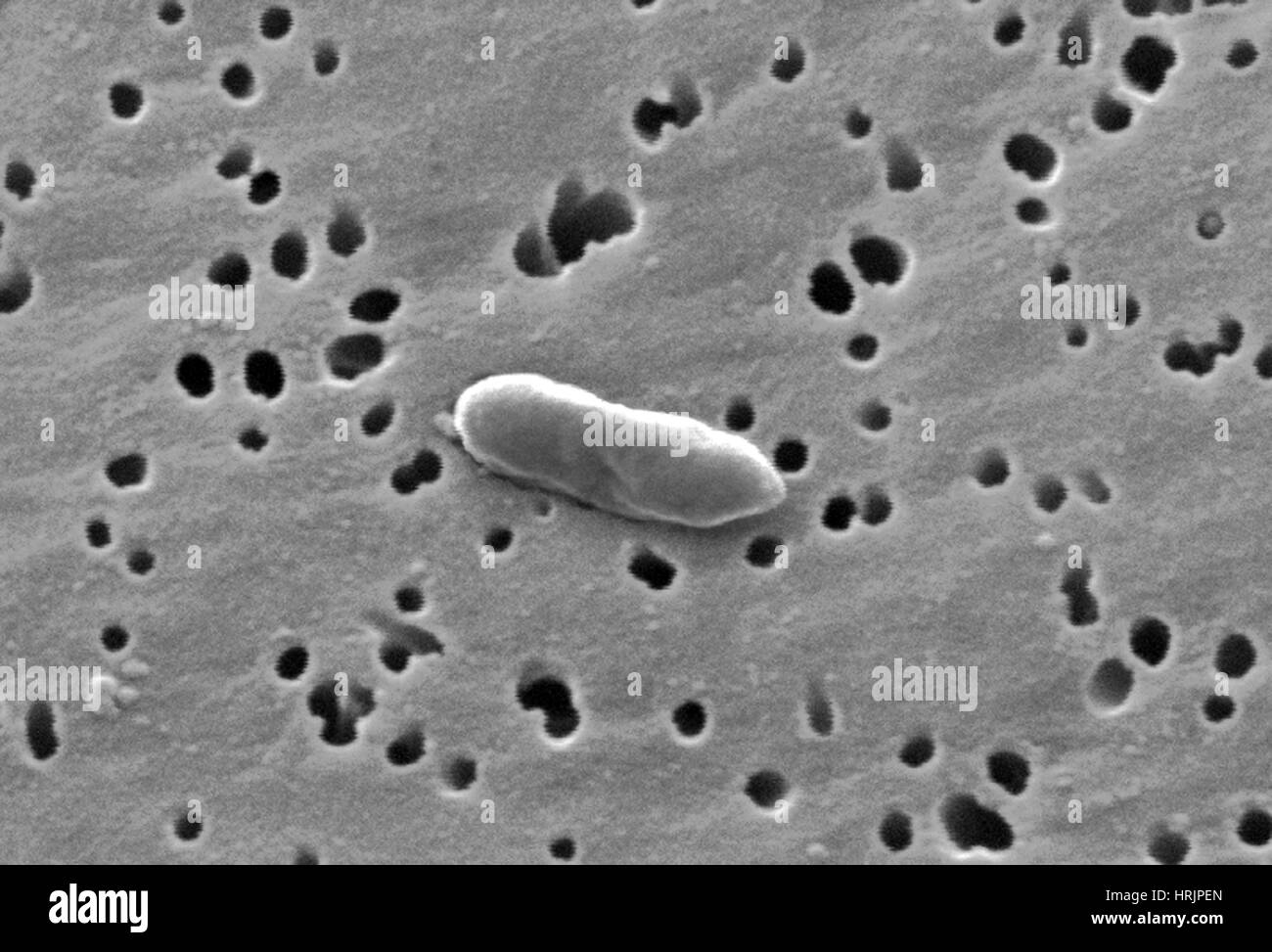 Sebaldella termitidis Bacteria Dividing, SEM Stock Photo - Alamy