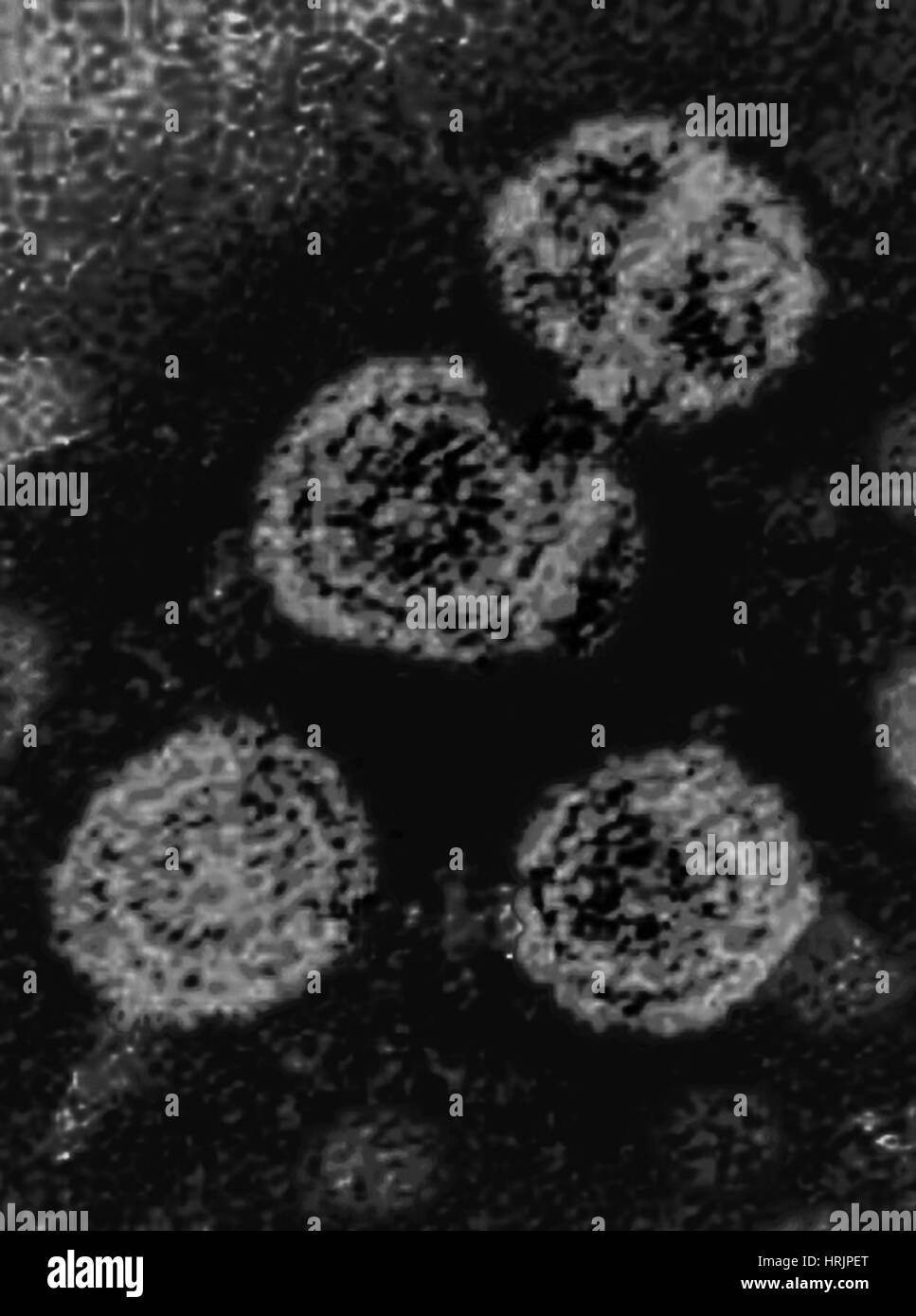 Hepatitis B Virus, SEM Stock Photo - Alamy