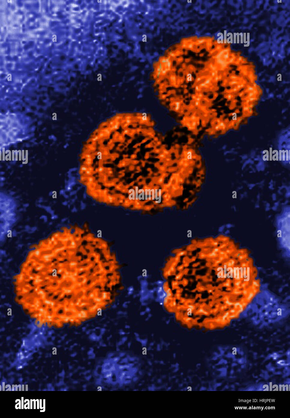 Hepatitis B Virus, SEM Stock Photo - Alamy