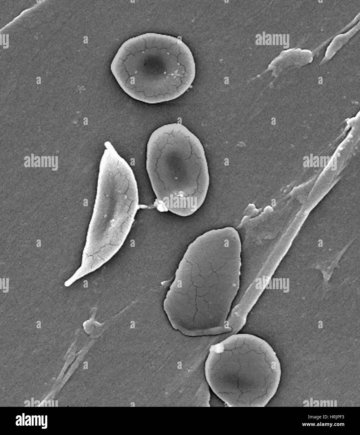 Electron Microscopy Human Cell High Resolution Stock Photography and ...