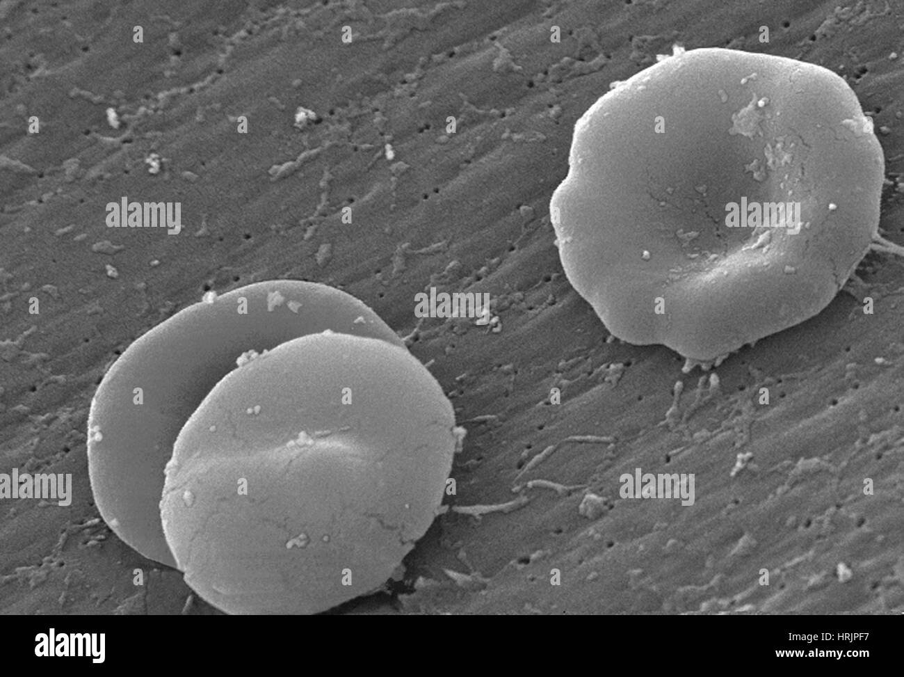 Electron Microscopy Human Cell High Resolution Stock Photography and ...