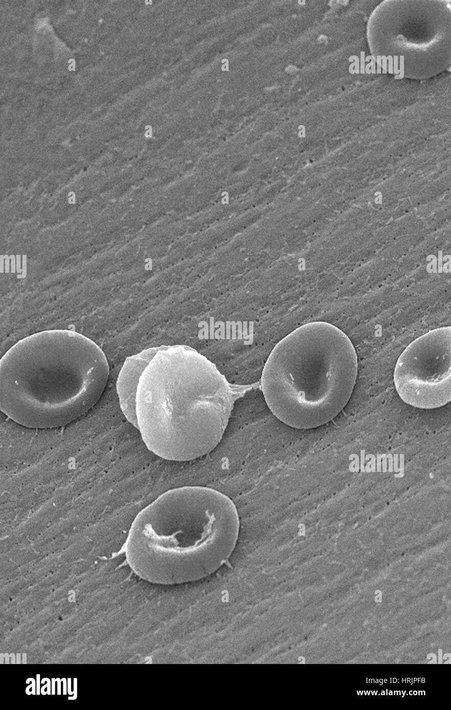 Electron Microscopy Human Cell High Resolution Stock Photography and ...