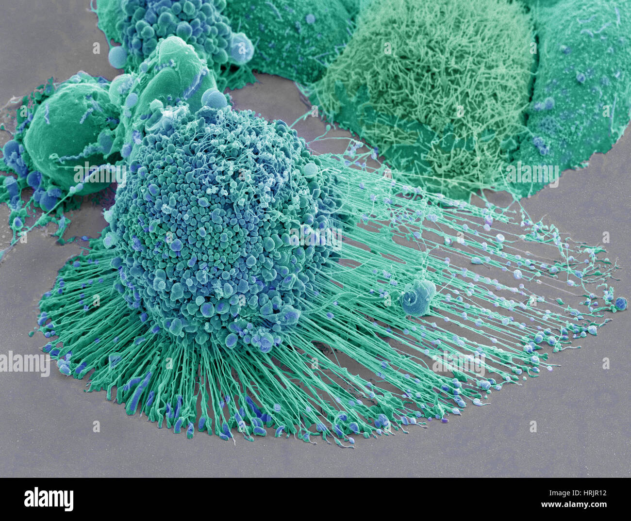 Hela cell hi-res stock photography and images - Alamy