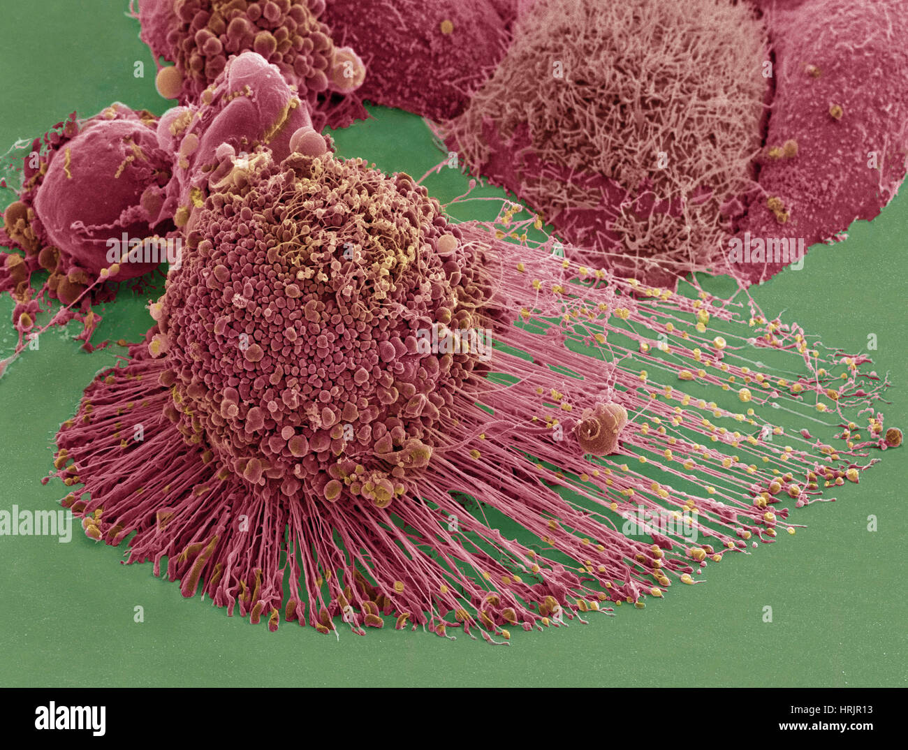 Hela cell hi-res stock photography and images - Alamy