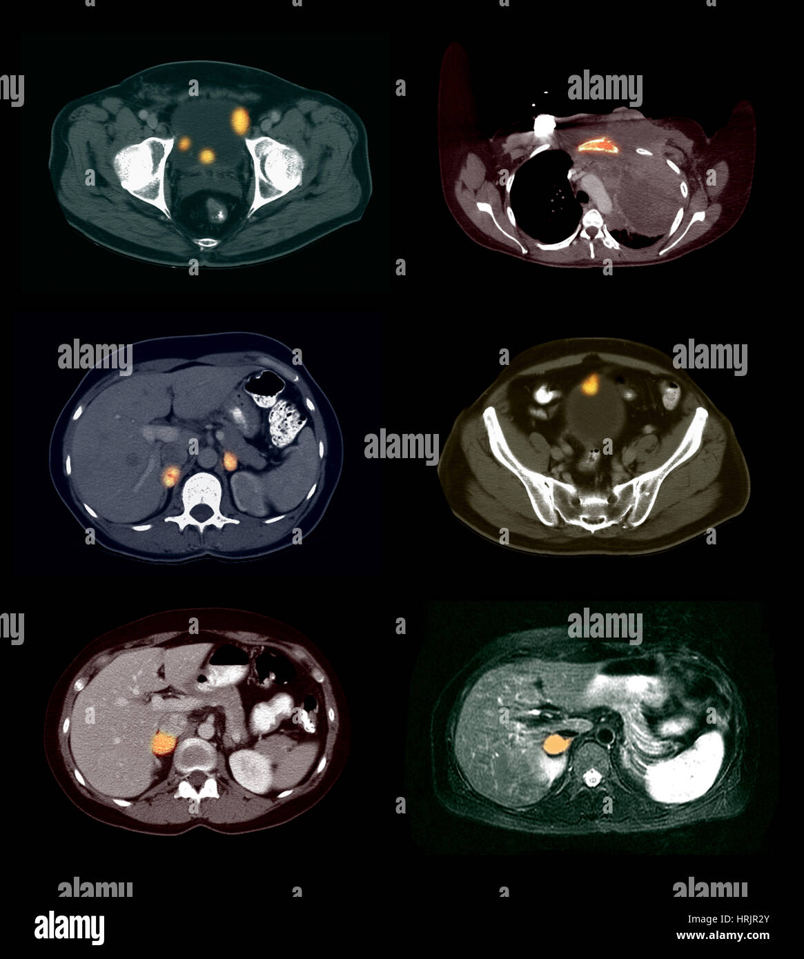 Mri nmr imaging hi-res stock photography and images - Alamy
